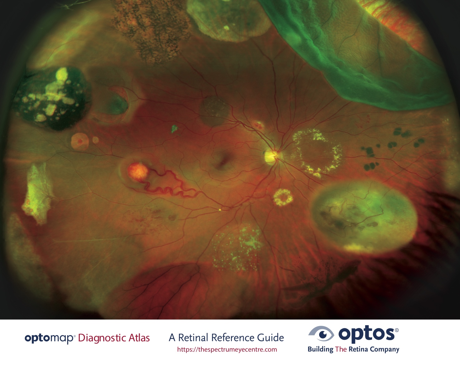 Optomap Diagnostics At The Spectrum Eye Centre - bryan.robertson - Page ...