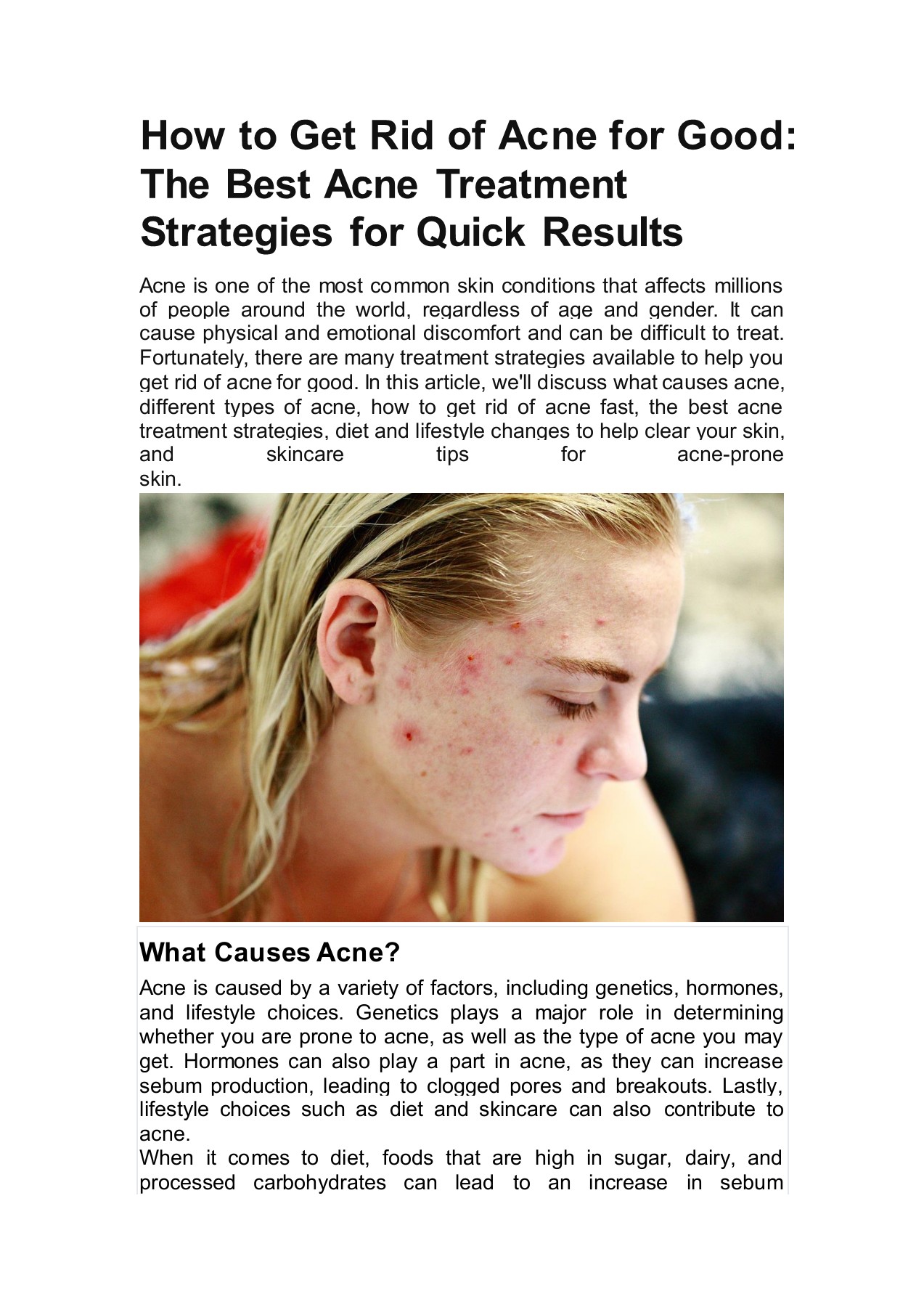 how to treat acne - youpeng zhang - Page 1 - 2 | Flip PDF Online | PubHTML5