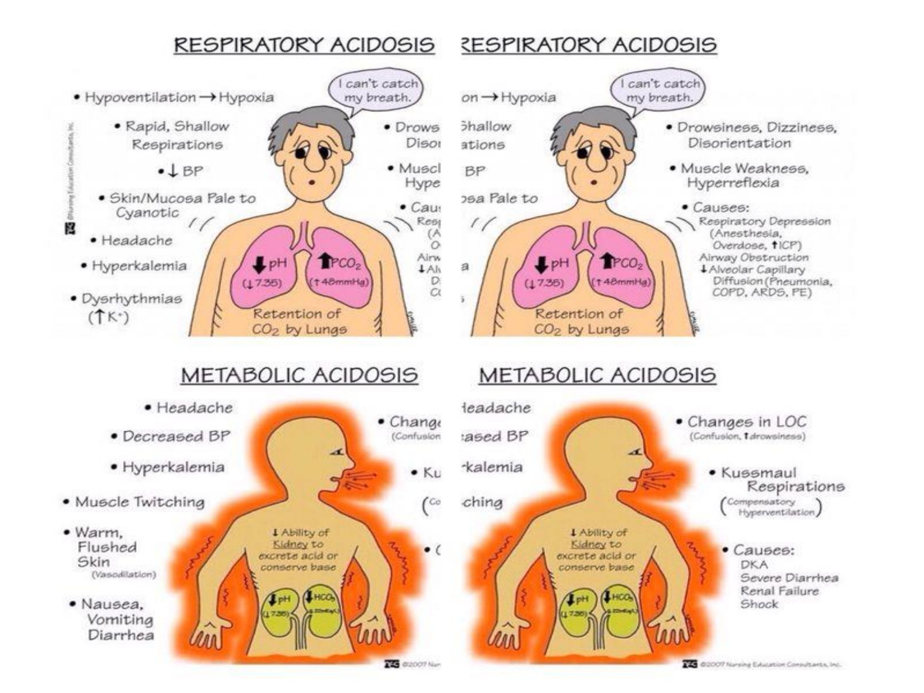 Powerpoint RespirationPatho - ladda723 - Page 70 | Flip PDF Online ...