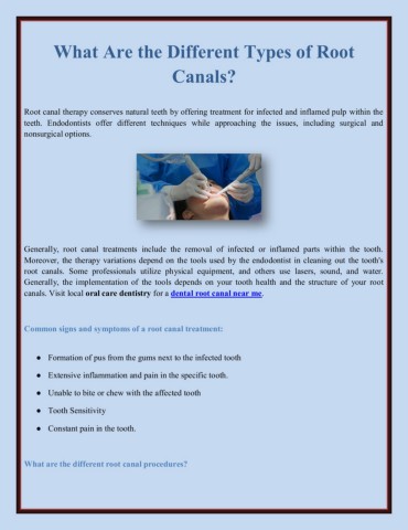 What Are the Different Types of Root Canals?