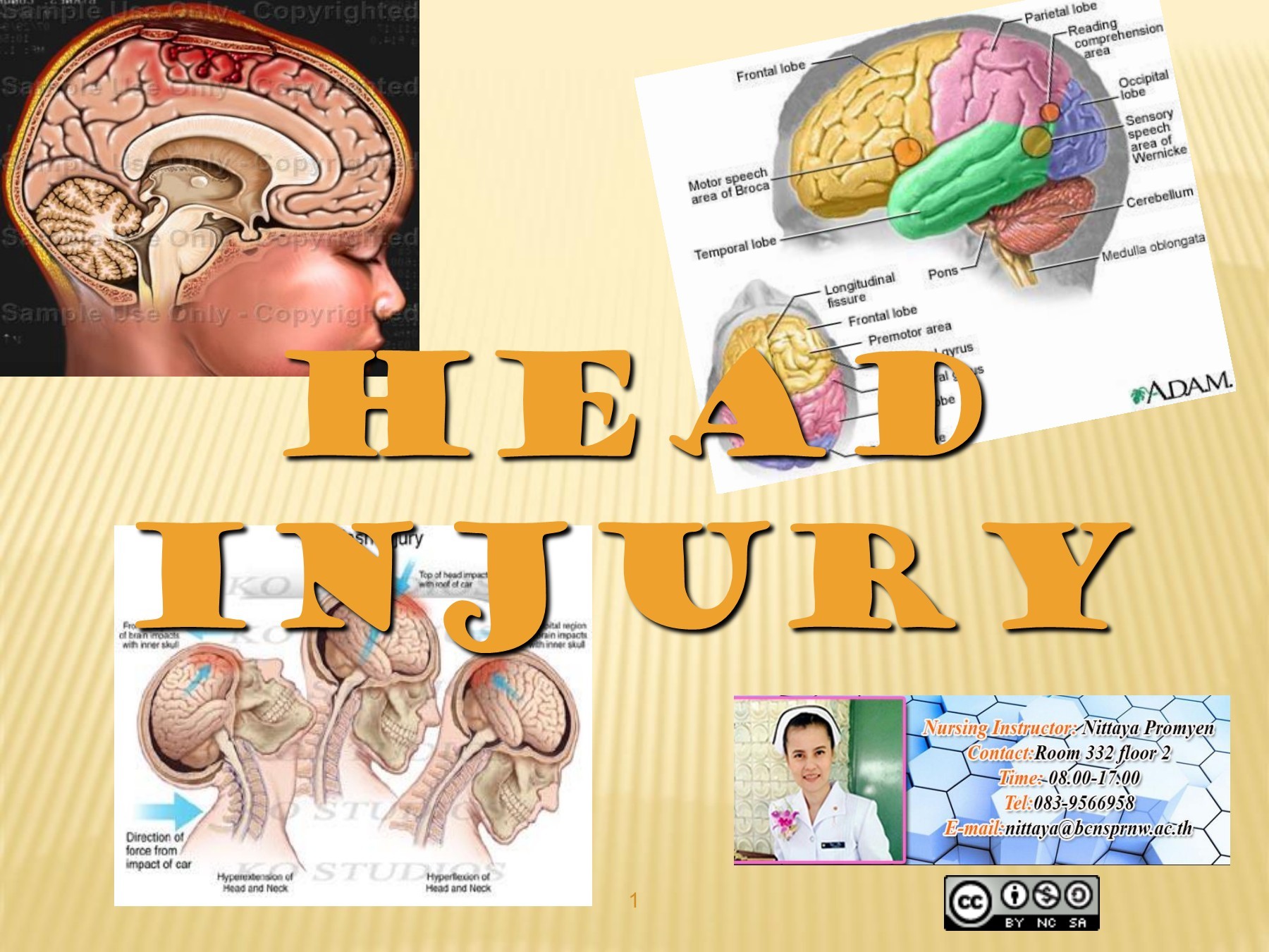 Headinjury - nittaya - หน้าหนังสือ 1 - 28 | พลิก PDF ออนไลน์ | PubHTML5