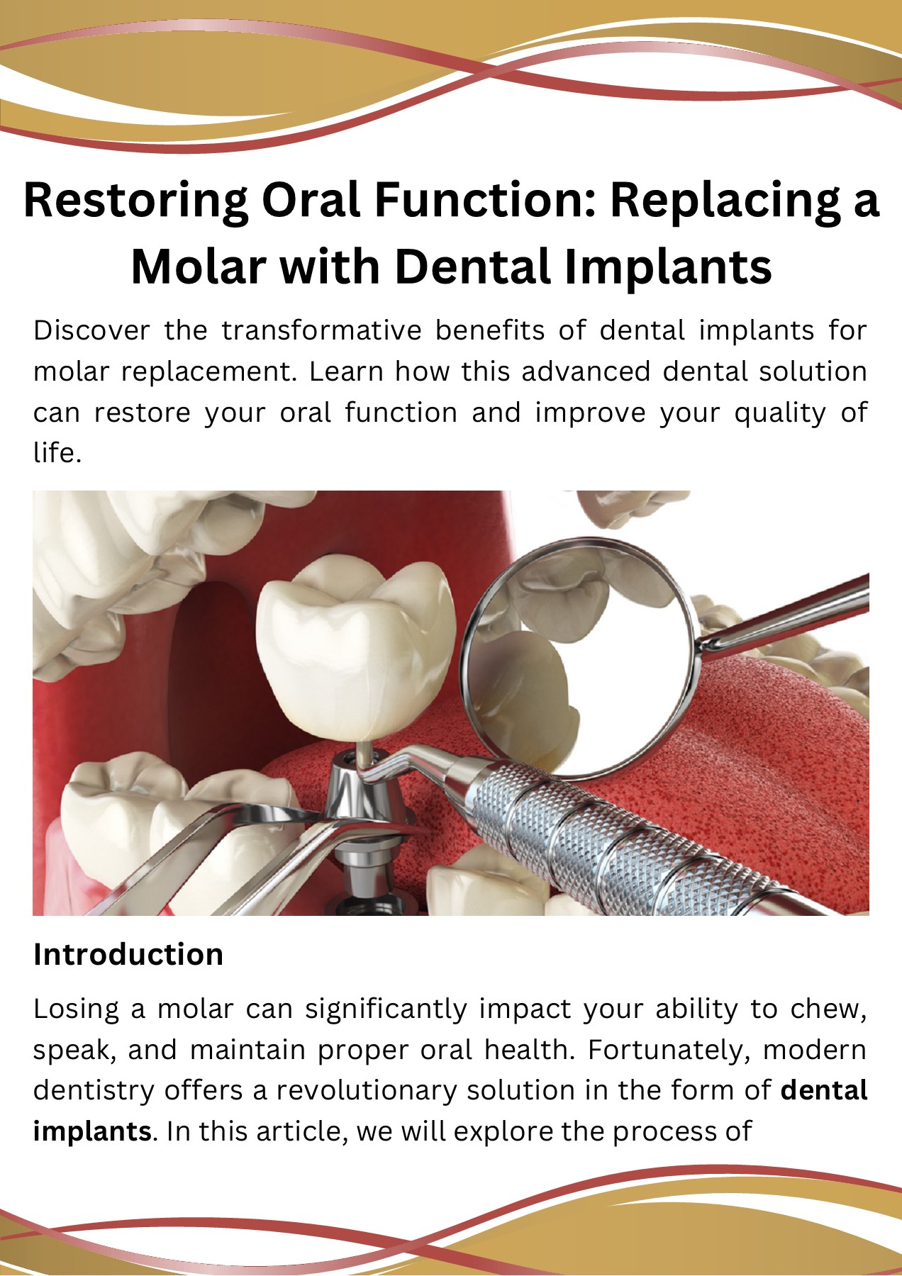 Restoring Oral Function- Replacing a Molar with Dental Implants - Royal ...