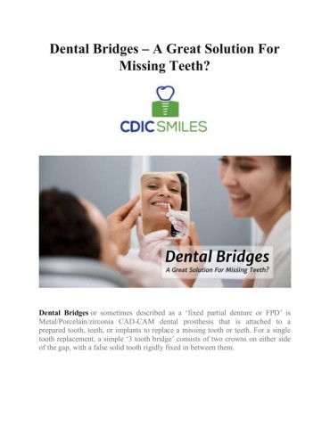 Dental Bridges – A Great Solution For Missing Teeth