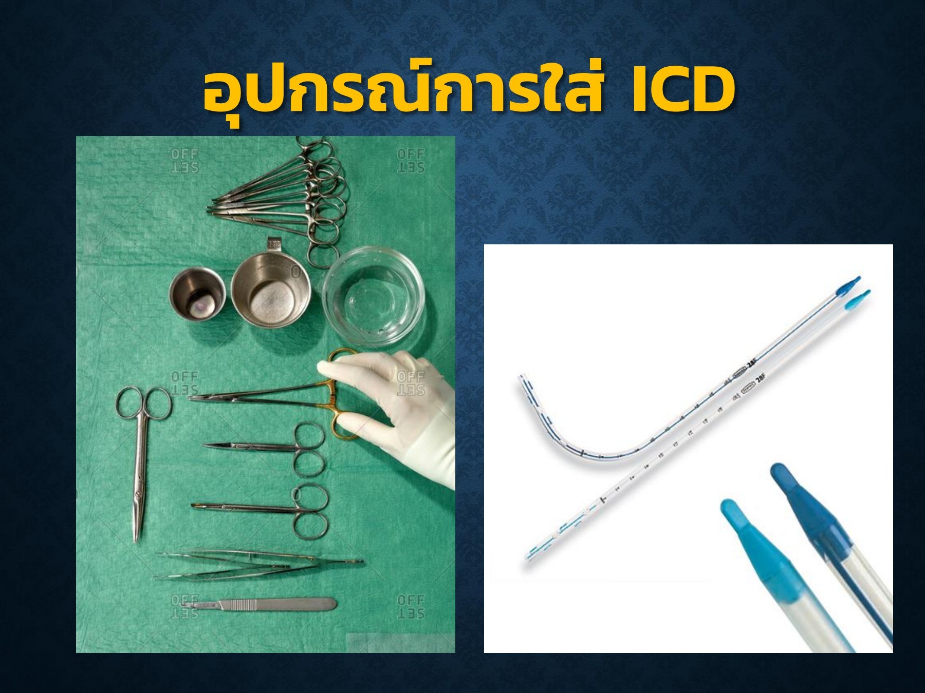 Chest drainage system - ไกรศร จันทร์นฤมิตร - หน้าหนังสือ 7 | พลิก PDF ...