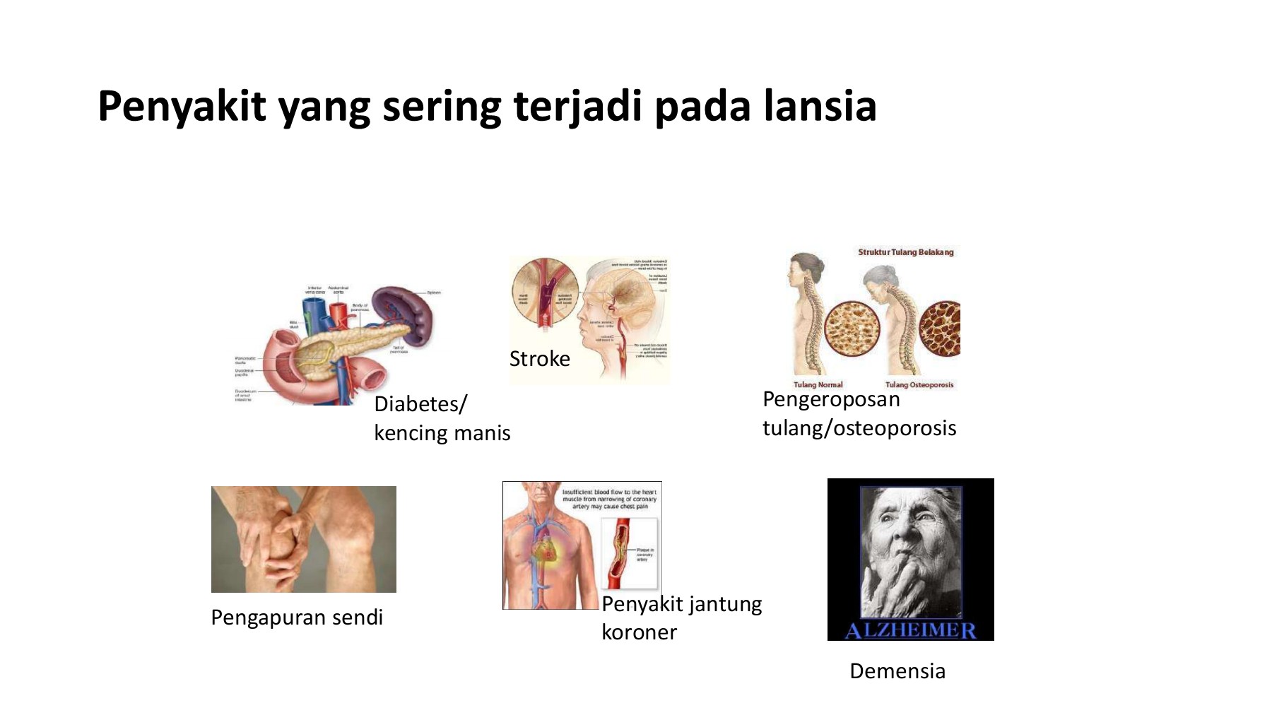 2 Pelayanan Kesehatan Geriatri - Kuntjoro Harimurti - sekretariat ...