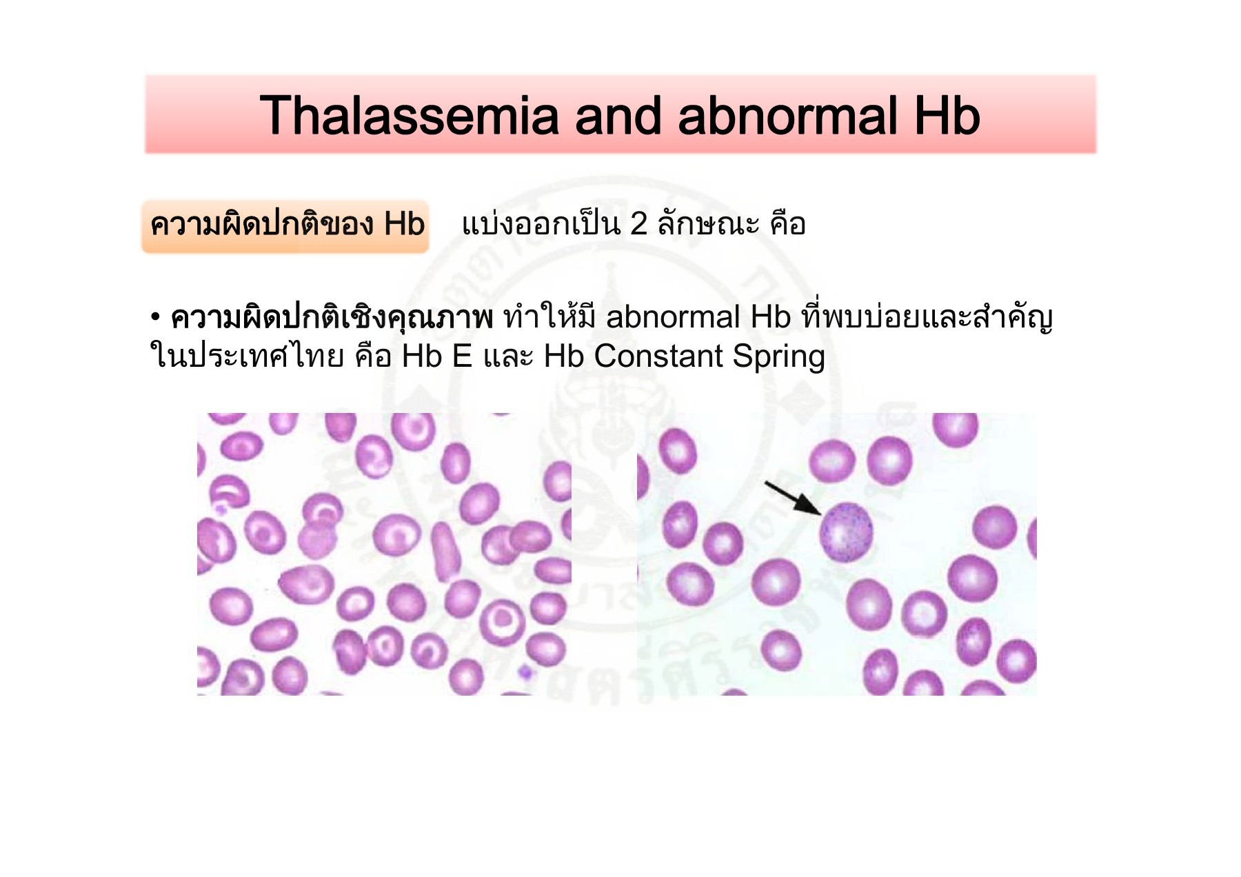 1 Thalassemia screening test - warida_12 - Page 4 | Flip PDF Online ...