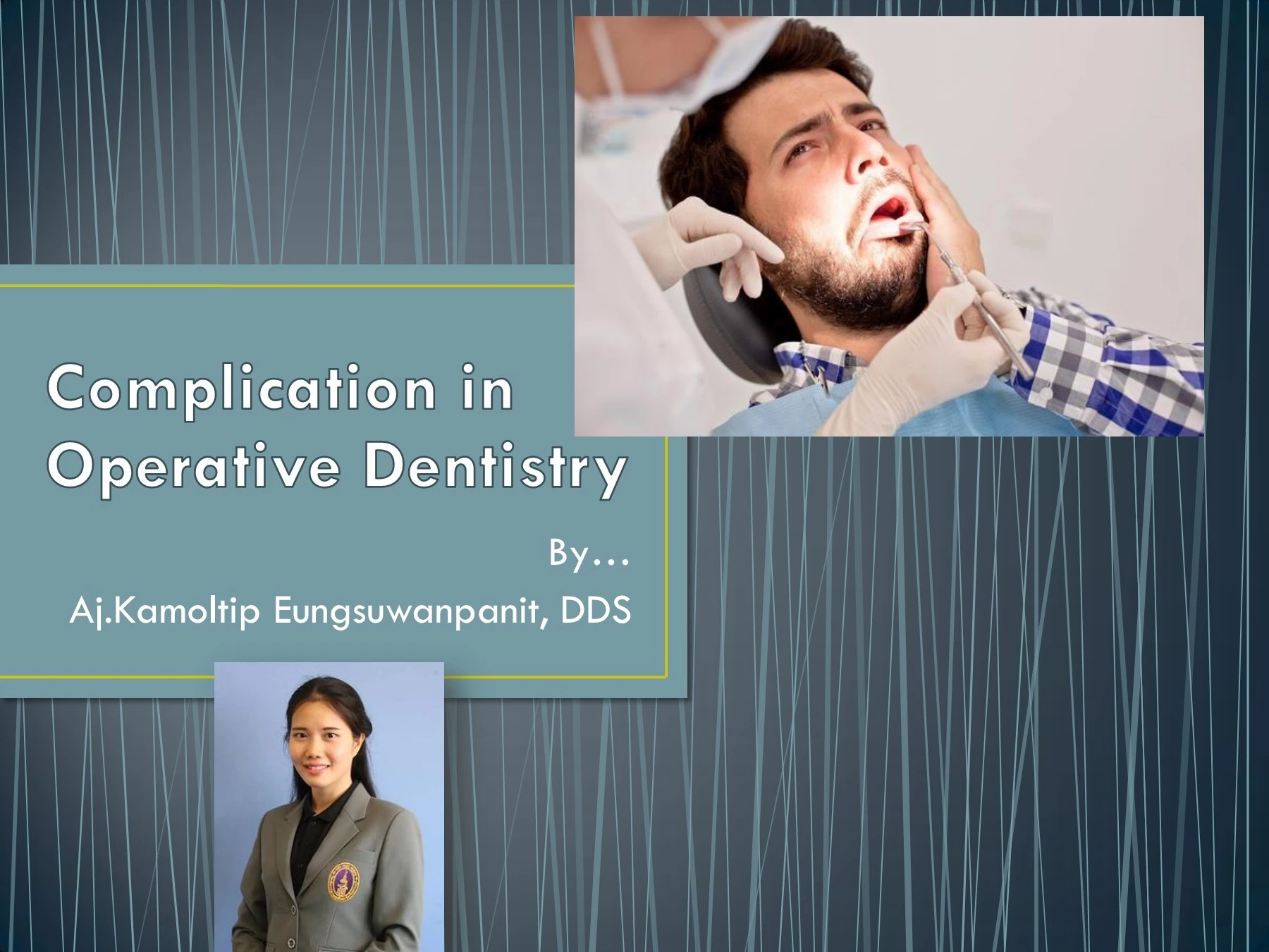 Complication in Operative Dentistry - kamoltip.eun - Page 1 - 15 | Flip ...