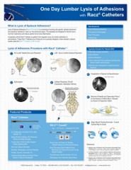 LT-215 Lumbar Lysis with Racz Catheters Rev 0 - kjoiner - Page 1 - 2 ...