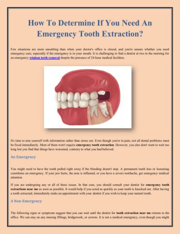 How To Determine If You Need An Emergency Tooth Extraction?