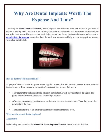 Why Are Dental Implants Worth The Expense And Time?