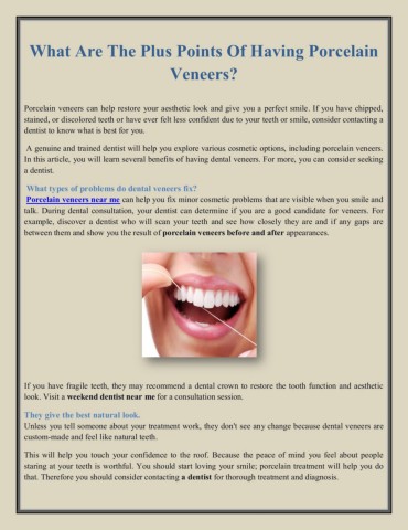 What Are The Plus Points Of Having Porcelain Veneers?