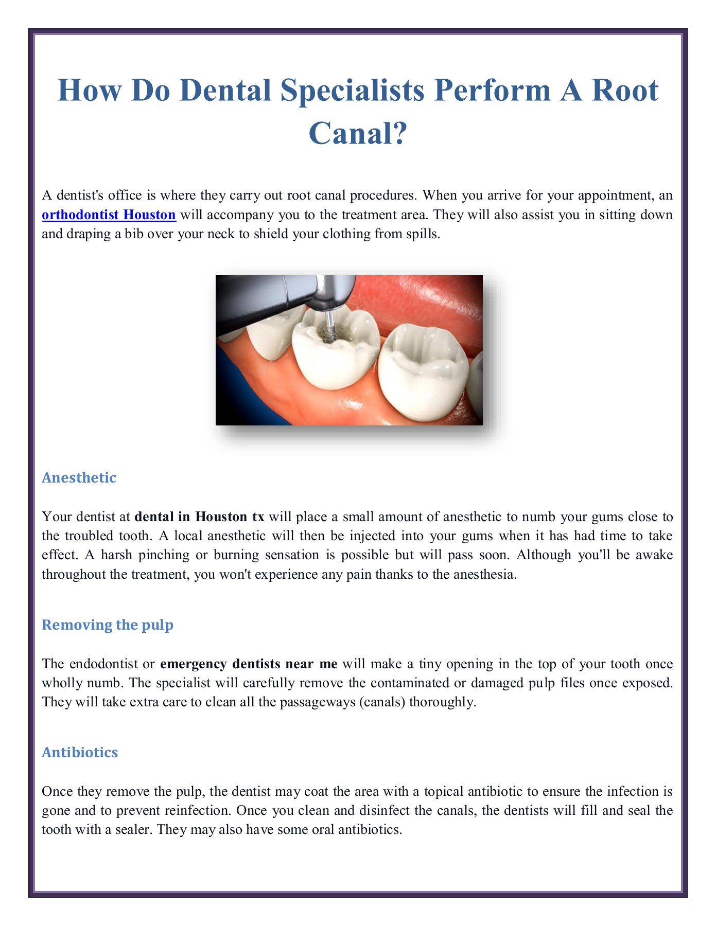How Do Dental Specialists Perform A Root Canal? - Laticia Gibson - Page 1 - 2 | Flip PDF Online ...