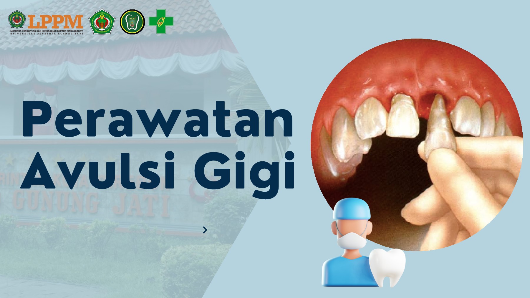 Perawatan Avulsi Gigi - Aldhy Doank - Halaman 1 - 21 | PDF Online | PubHTML5