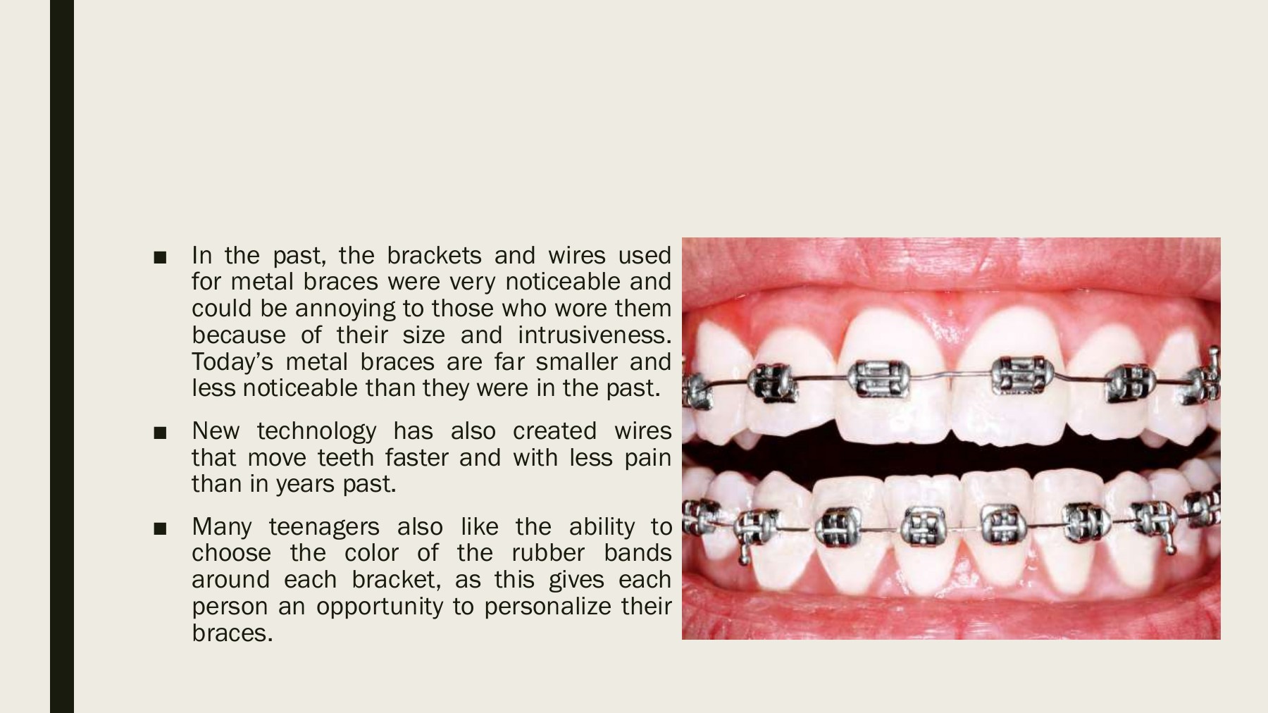 The 5 Most Common Types of Braces - Mark Leonard - Page 4 | Flip PDF ...