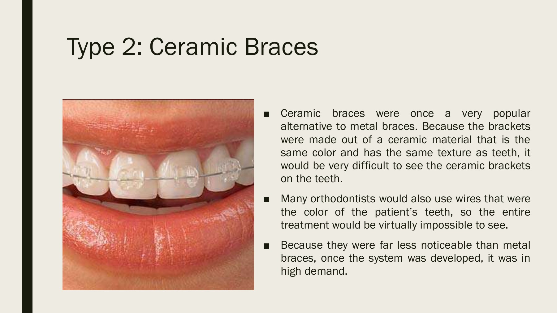 The 5 Most Common Types of Braces - Mark Leonard - Page 5 | Flip PDF ...