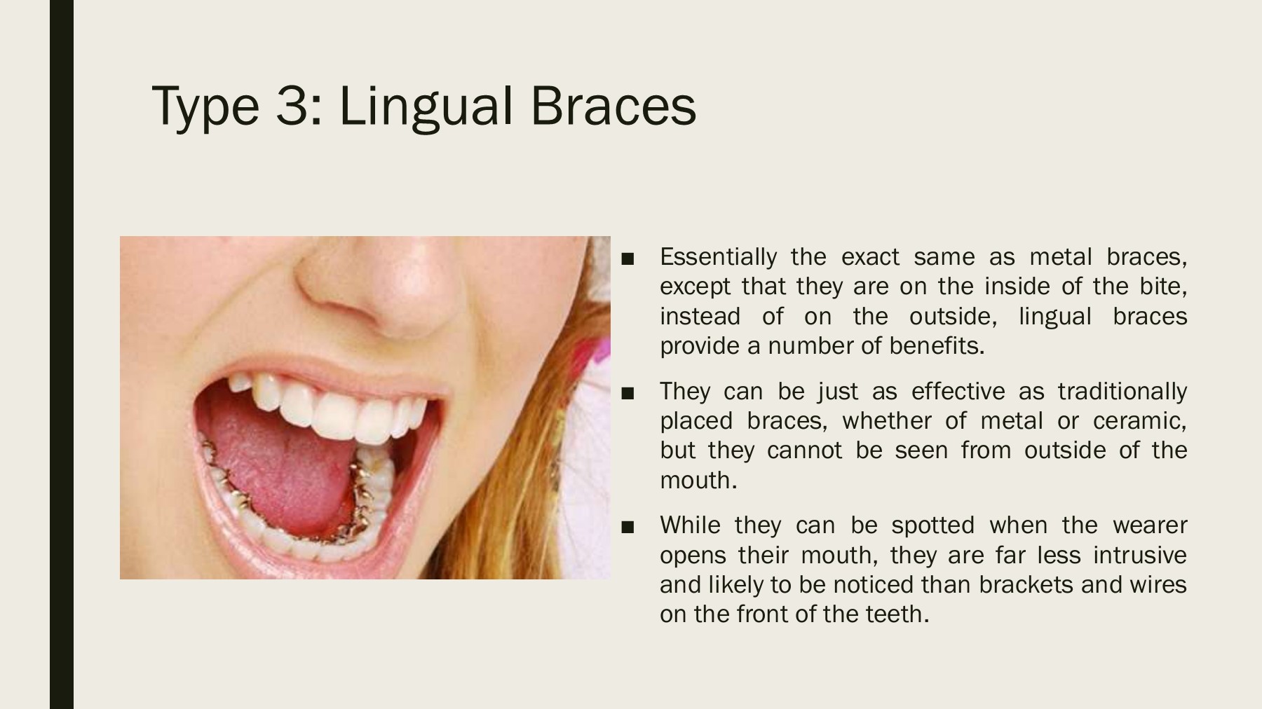 The 5 Most Common Types of Braces - Mark Leonard - Page 7 | Flip PDF ...