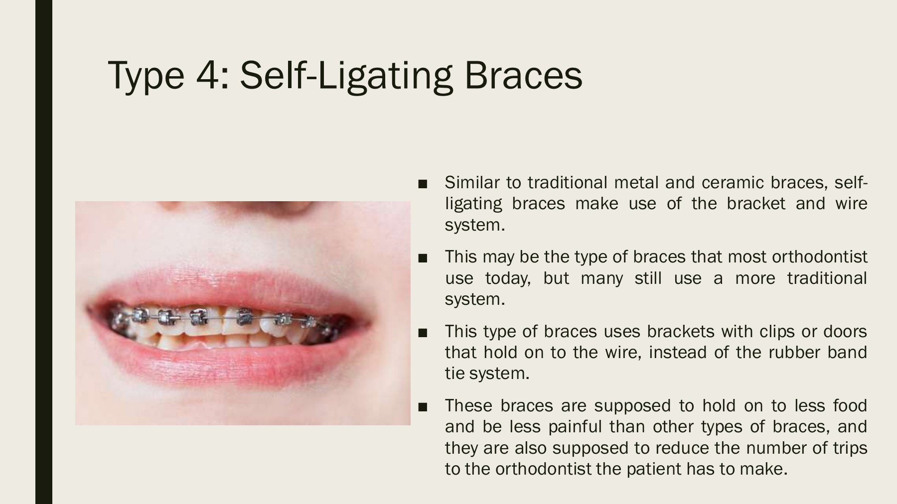 The 5 Most Common Types of Braces - Mark Leonard - Page 9 | Flip PDF ...