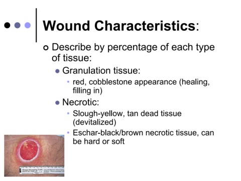 Wound-Care-The-Basics - kanphitcha.3668 - Page 7 | Flip PDF Online ...