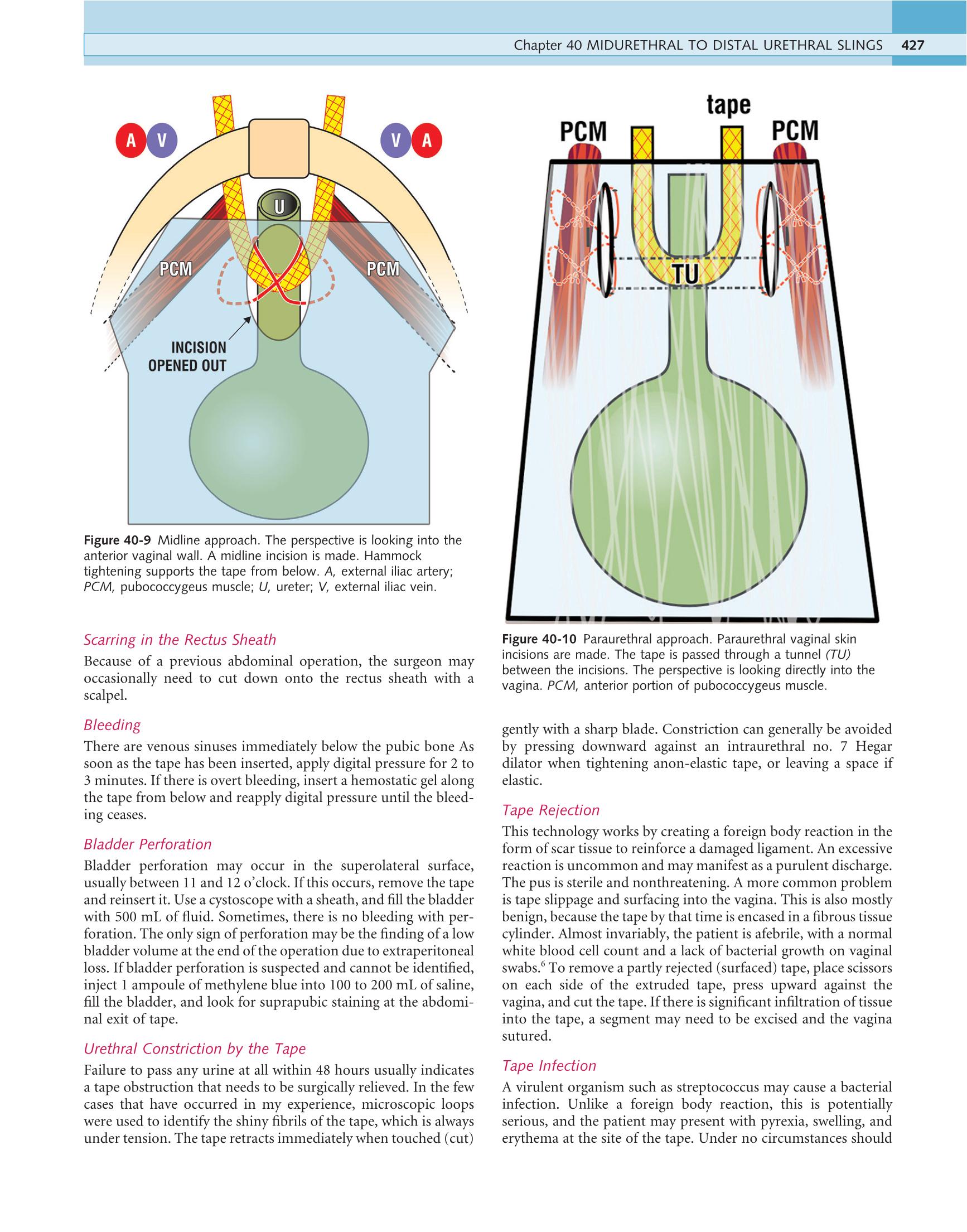 FEMALE UROLOGY - chinzoobaaska - Page 425 | Flip PDF Online | PubHTML5