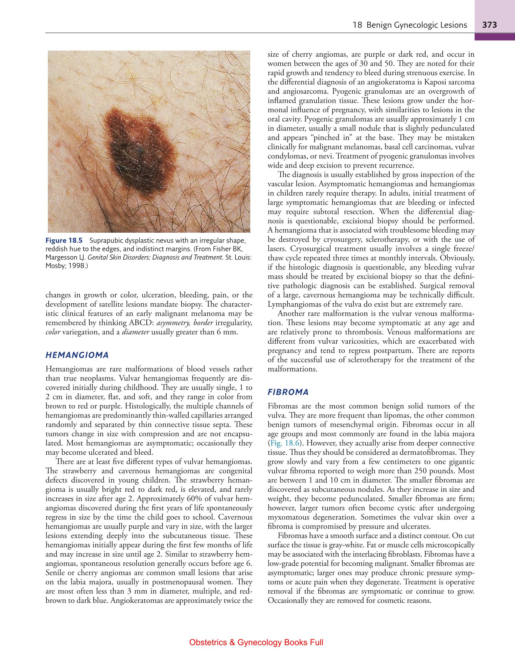 Comprehensive Gynecology - chinzoobaaska - Page 418 | Flip PDF Online ...