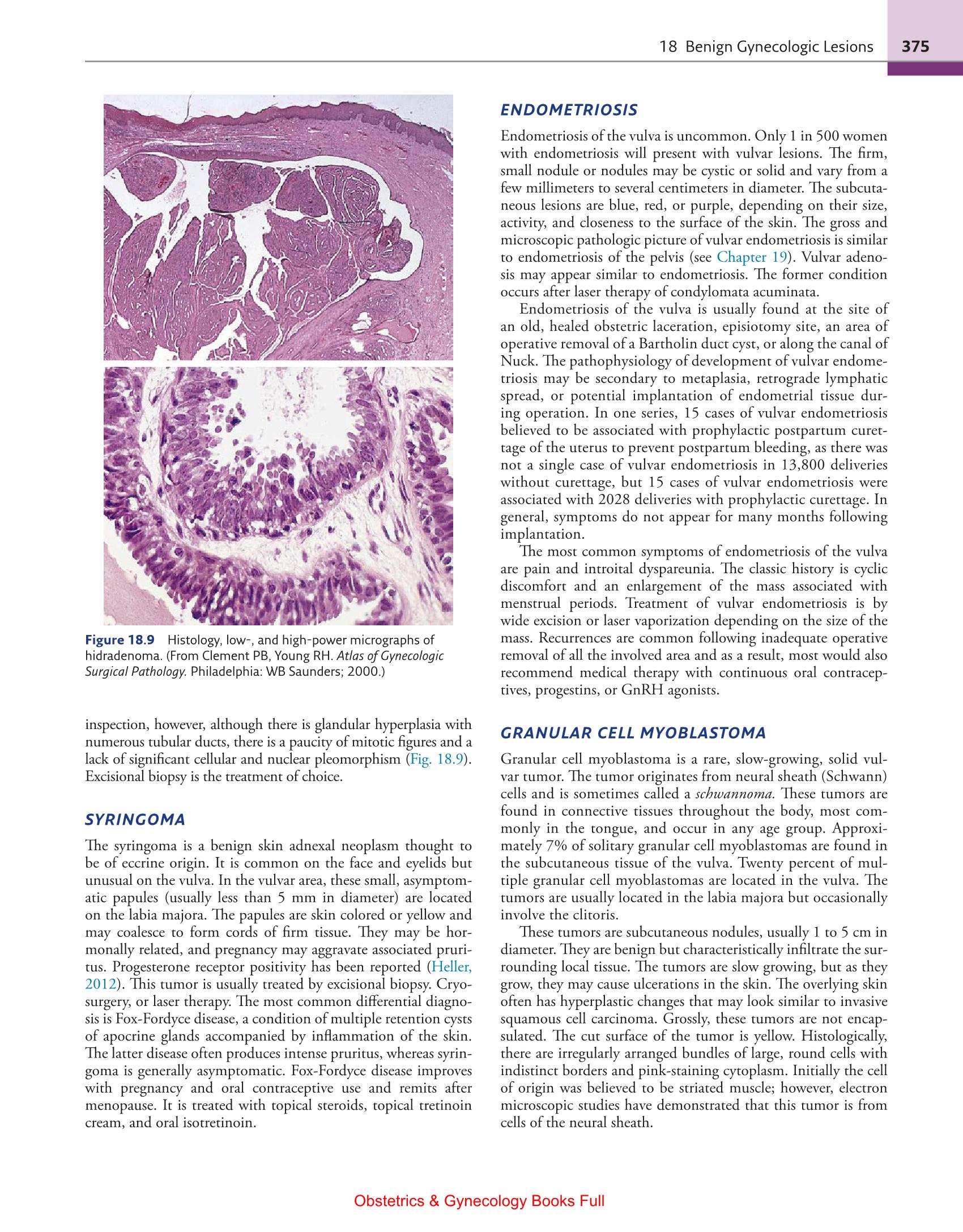 Comprehensive Gynecology - chinzoobaaska - Page 420 | Flip PDF Online ...