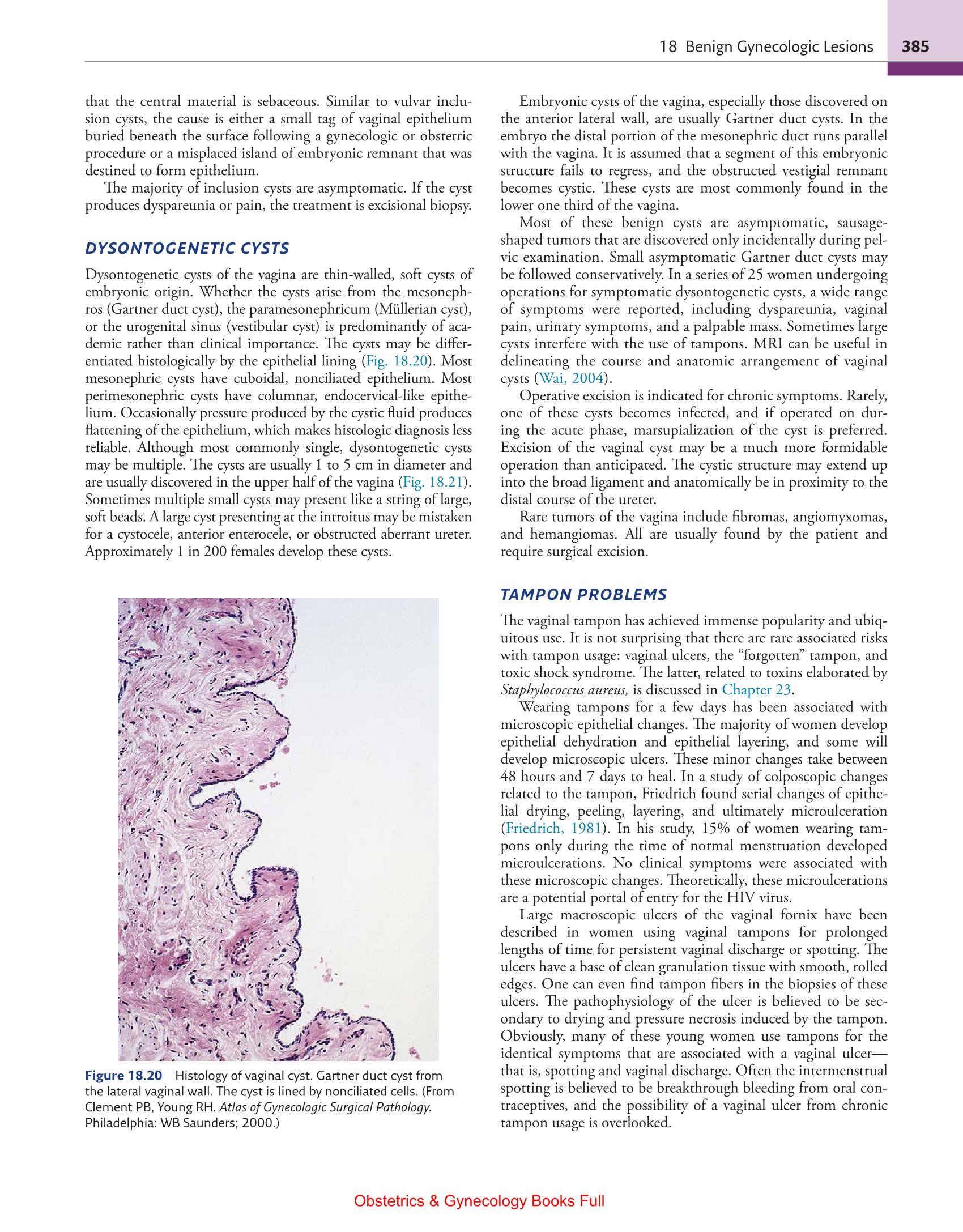 Comprehensive Gynecology - chinzoobaaska - Page 430 | Flip PDF Online ...