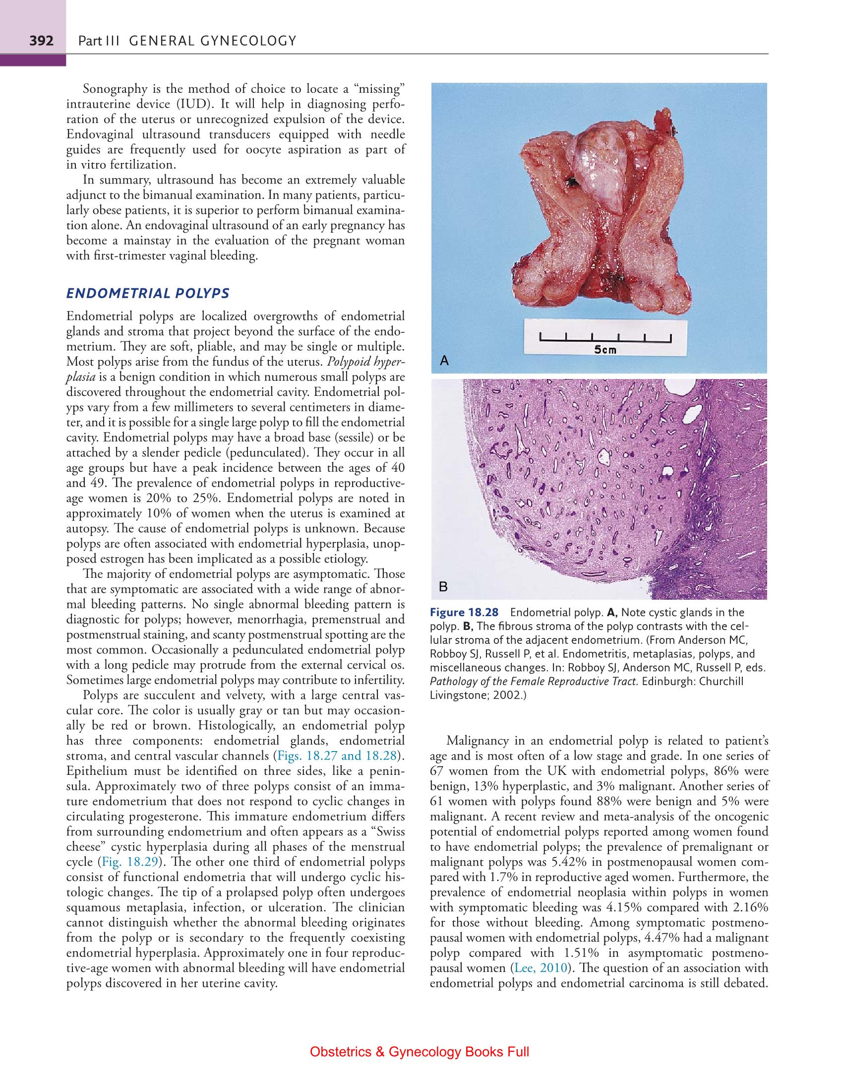 Comprehensive Gynecology - chinzoobaaska - Page 437 | Flip PDF Online ...