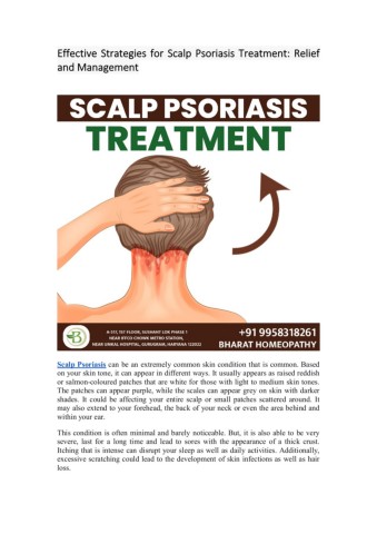 Effective Strategies for Scalp Psoriasis Treatment: Relief and Management