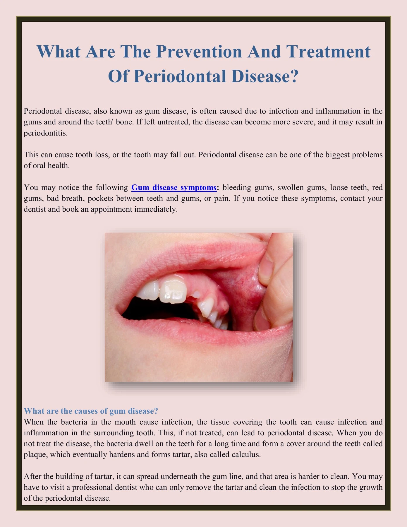 What Are The Prevention And Treatment Of Periodontal Disease ...