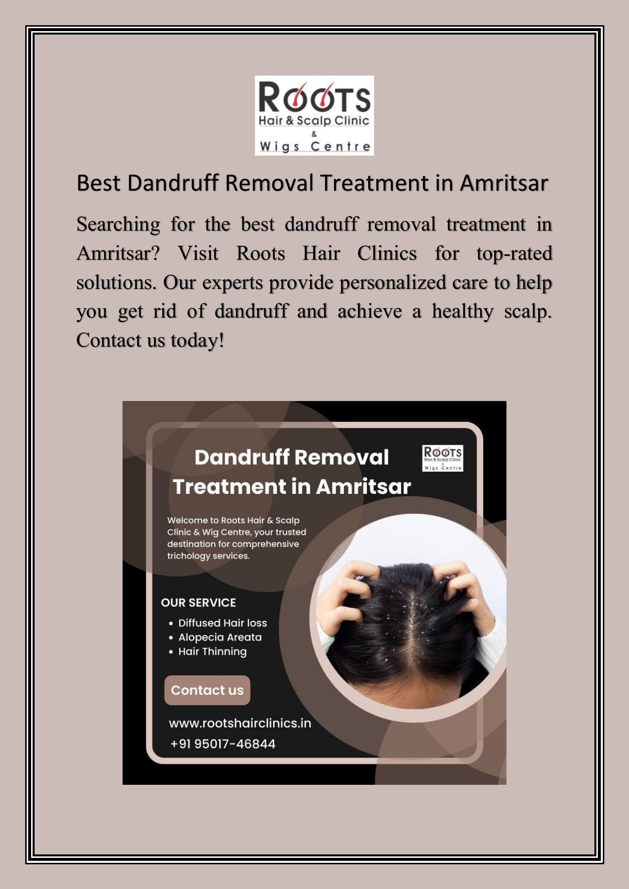 Best Dandruff Removal Treatment in Amritsar | Roots Hair Clinics ...