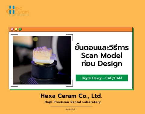 RPD - ขั้นตอนและวิธีการ Scan Model ก่อน Design - Hexa Ceram Library ...