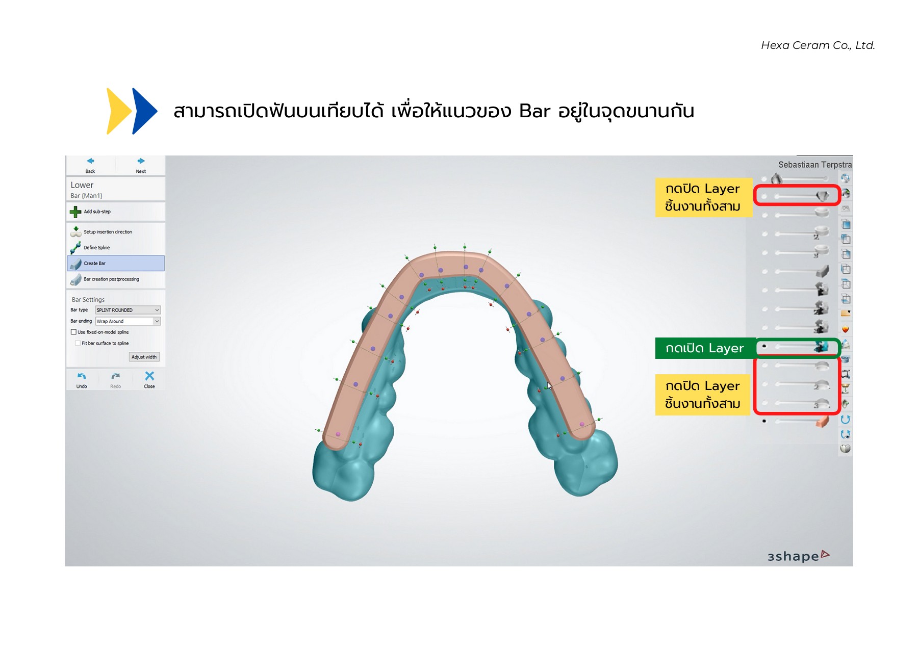Ortho - Stop (ฟันล่าง) - Hexa Ceram Library - หน้าหนังสือ 37 | พลิก PDF ...