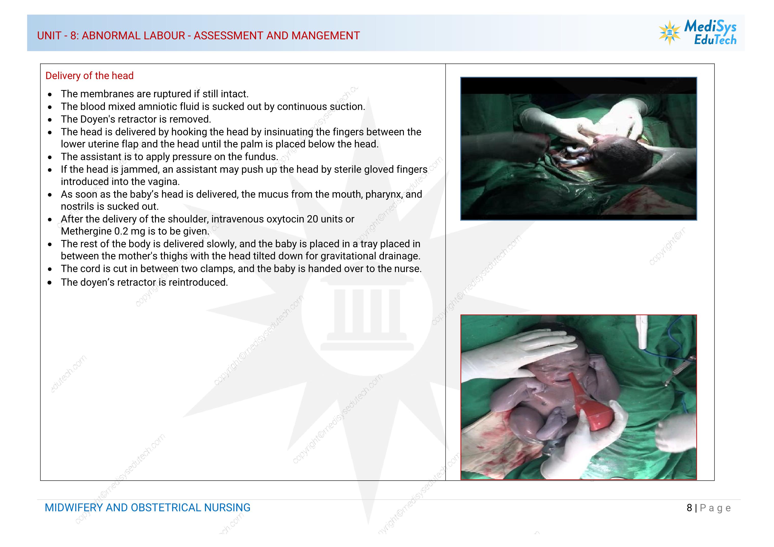Caesarean Section final_30072019 - soori0110 - Page 8 | Flip PDF Online | PubHTML5