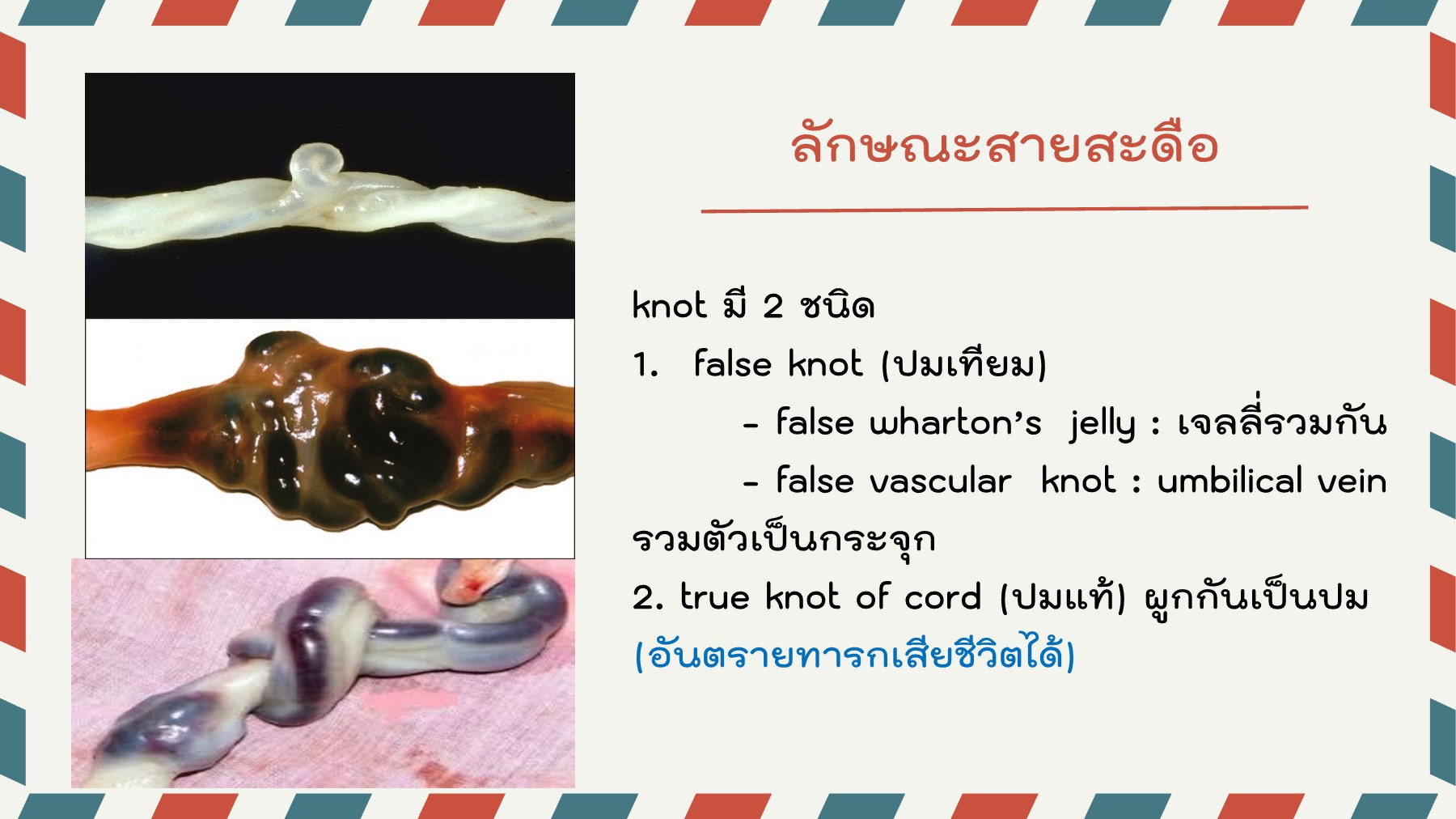 หน่วยการเรียนรู้ทที่ 4 เรื่องการตั้งครรภ์ (PPT) - หงษาวดี โยธาทิพย์ ...