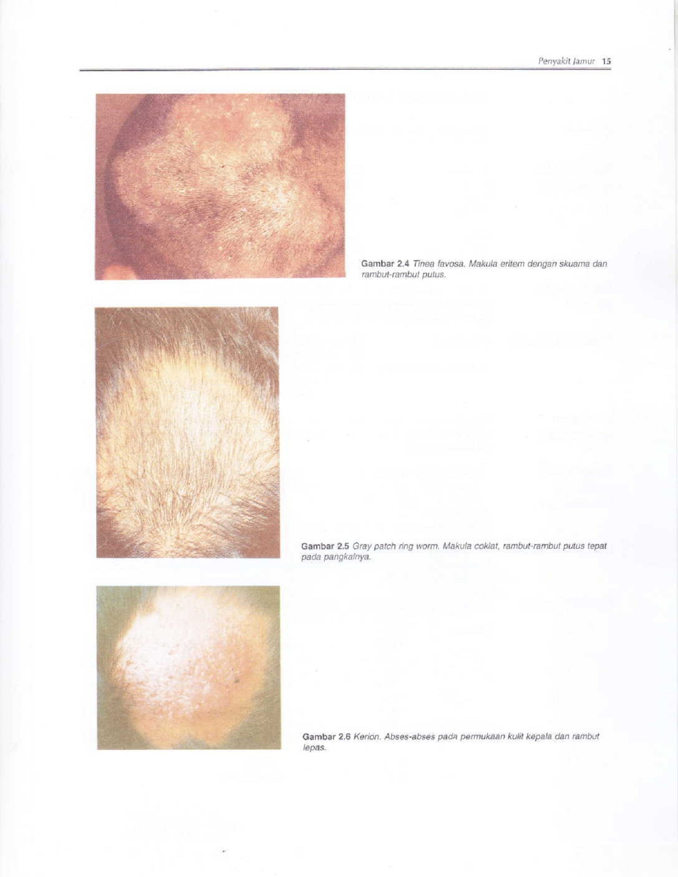 Bab 2. Penyakit Jamur - haryahutamas - Halaman 6 | PDF Online | PubHTML5