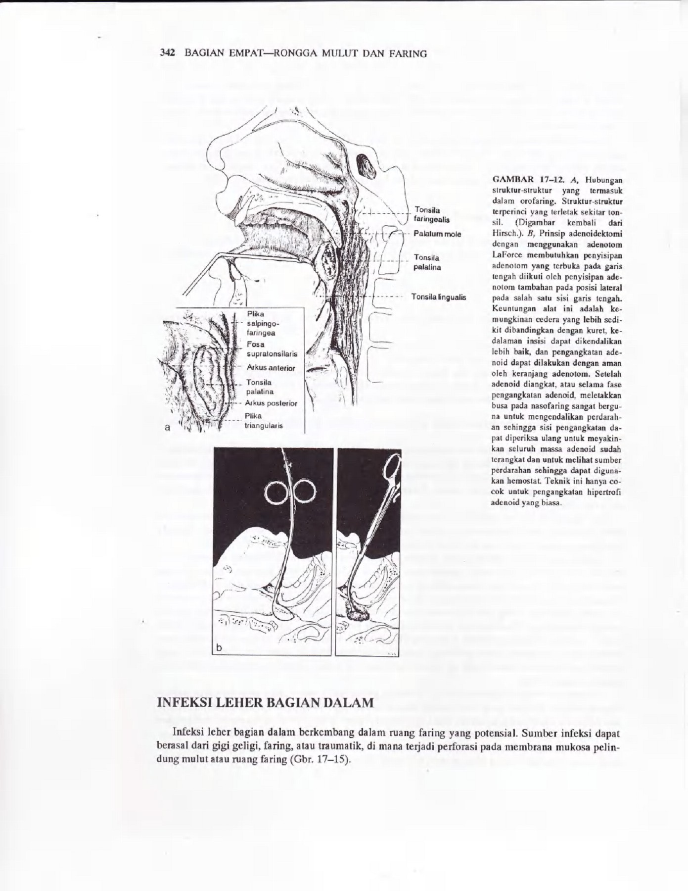 17. PENYAKIT-PENYAKIT NASOFARING DAN OROFARING - haryahutamas - Halaman ...