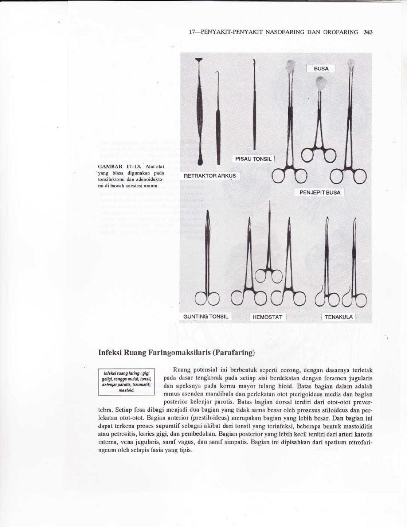 17. PENYAKIT-PENYAKIT NASOFARING DAN OROFARING - haryahutamas - Halaman ...