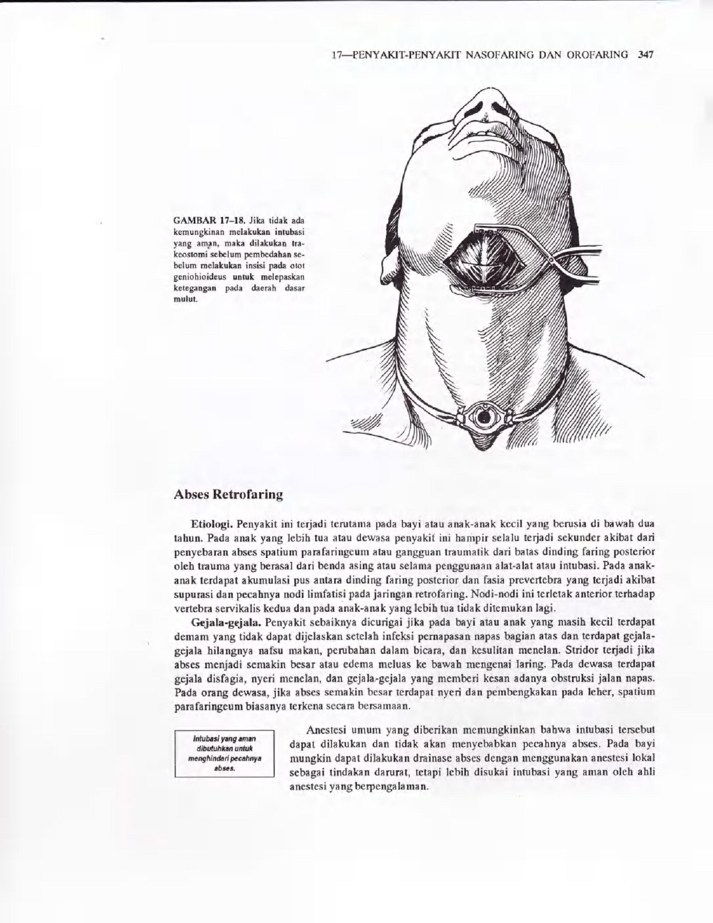 17. PENYAKIT-PENYAKIT NASOFARING DAN OROFARING - haryahutamas - Halaman ...