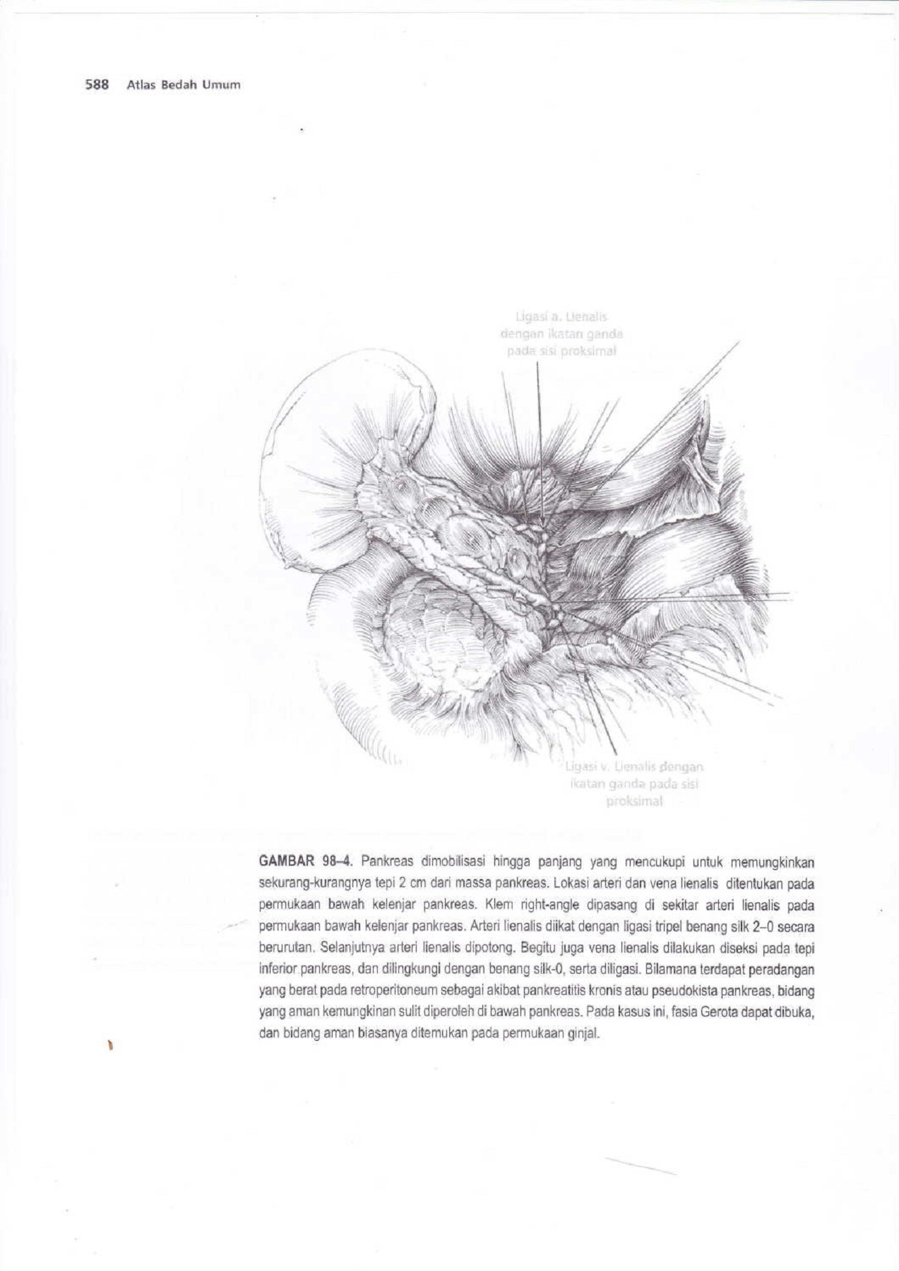 Bagian X - Pankreas - haryahutamas - Page 6 | Flip PDF Online | PubHTML5