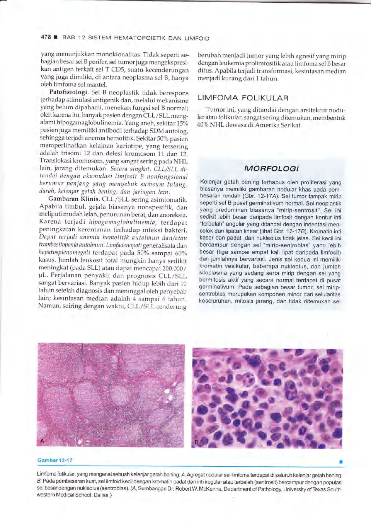 12. Sistem Hematopoietik dan Limfoid - haryahutamas - Halaman 36 | PDF ...