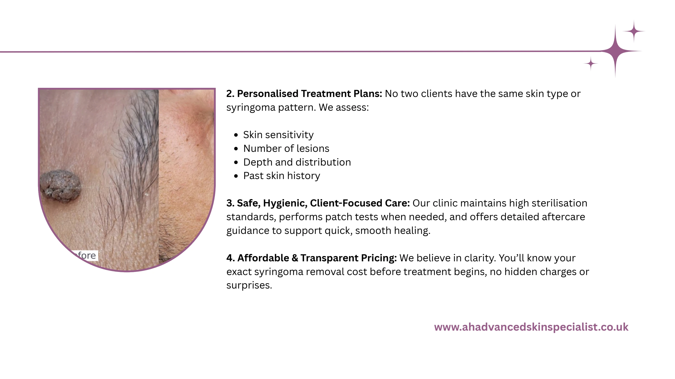 Syringoma Removal Cost Range, Factors Affecting it & How to Choose - A ...