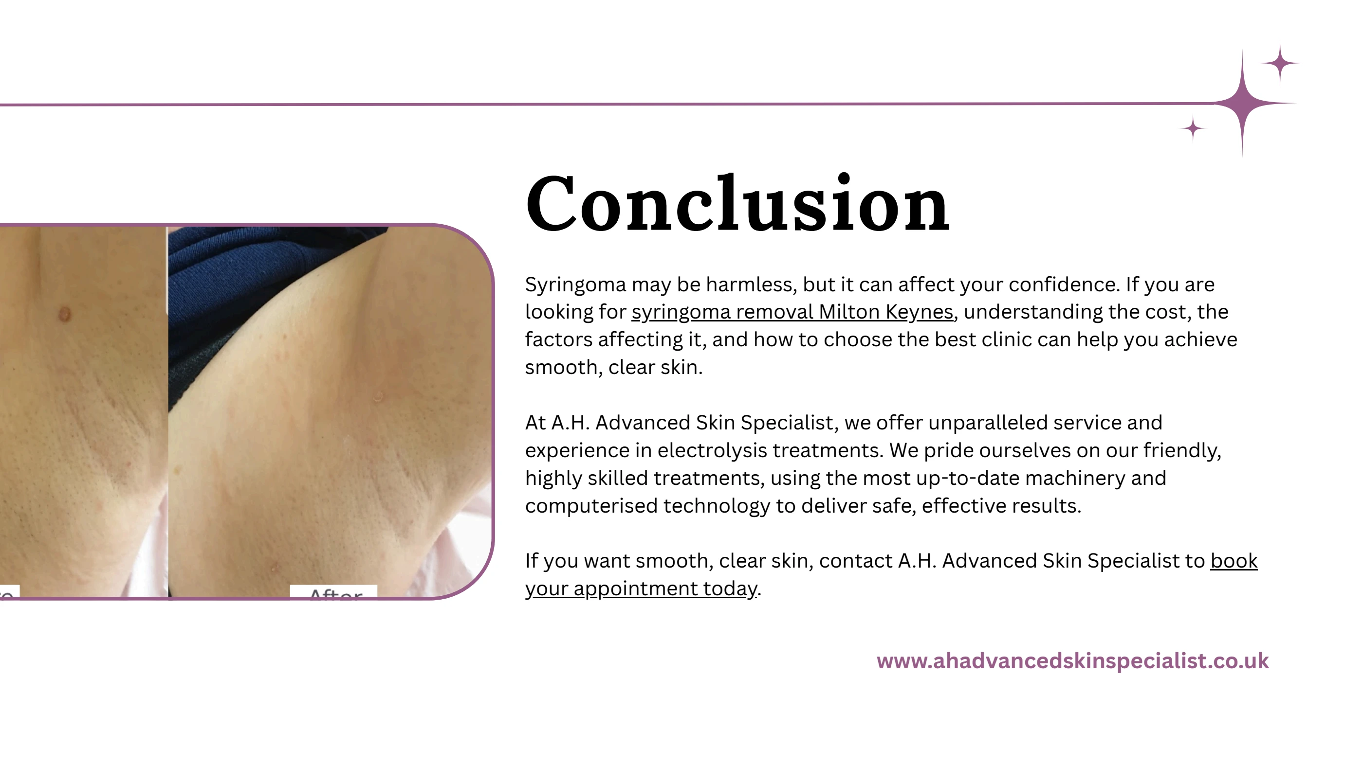 Syringoma Removal Cost Range, Factors Affecting it & How to Choose - A ...