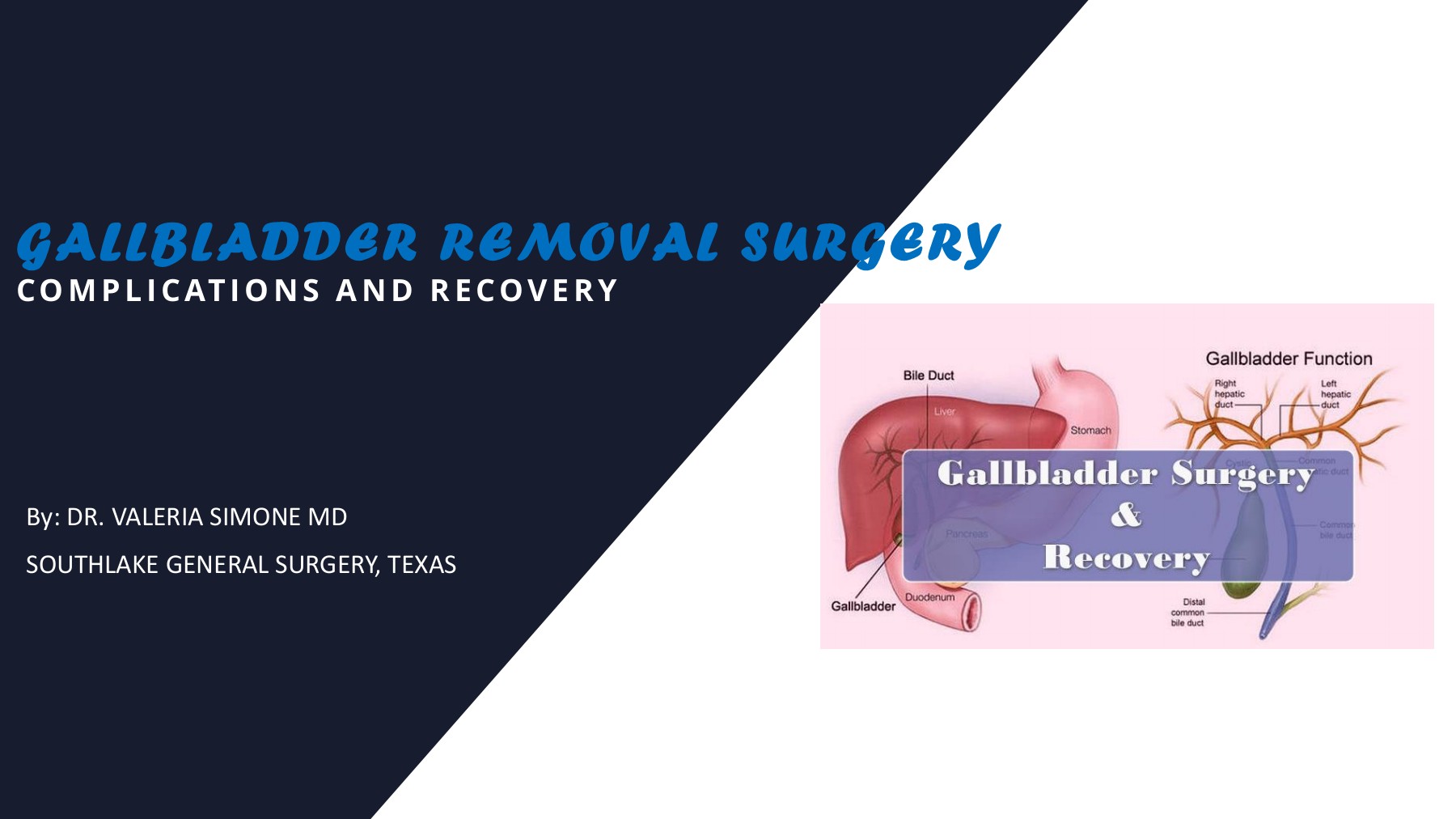 Gallbladder Removal Surgery- Complications and Recovery - Southlake ...