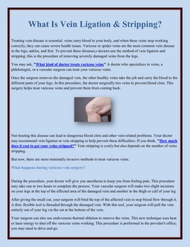What Is Vein Ligation & Stripping?