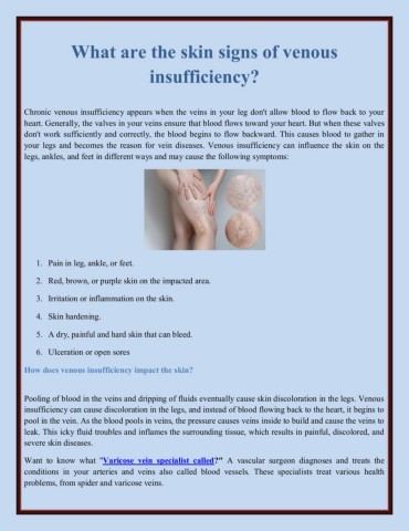 What are the skin signs of venous insufficiency?