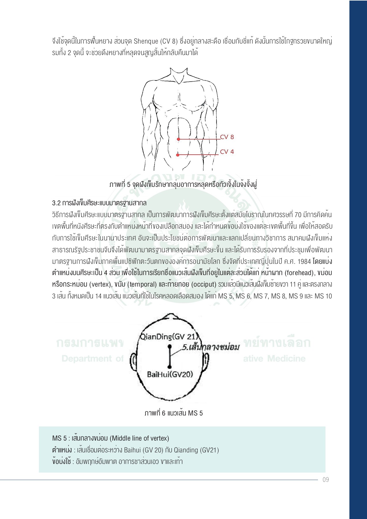 แนวทางการจัดบริการฝังเข็มโรคหลอดเลือดสมองระยะฟื้นฟู - ห้องสมุดประชาชน ...