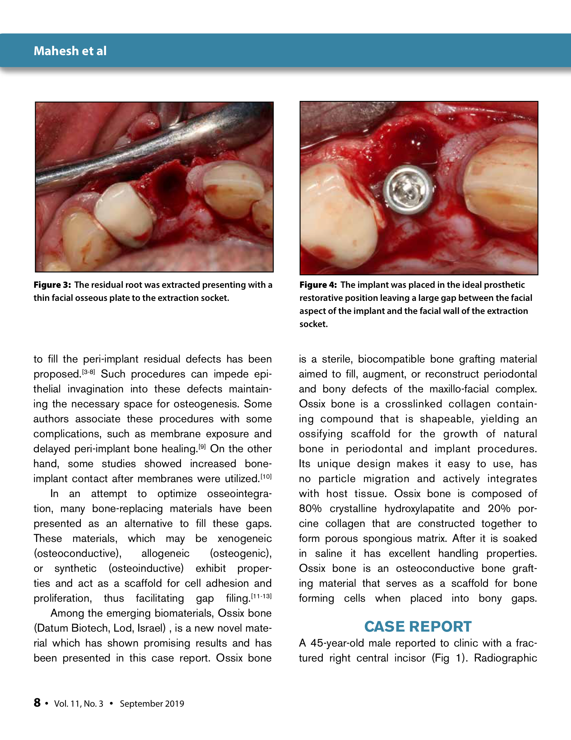 Journal of Implant and Advanced Clinical Dentistry September 2019 ...