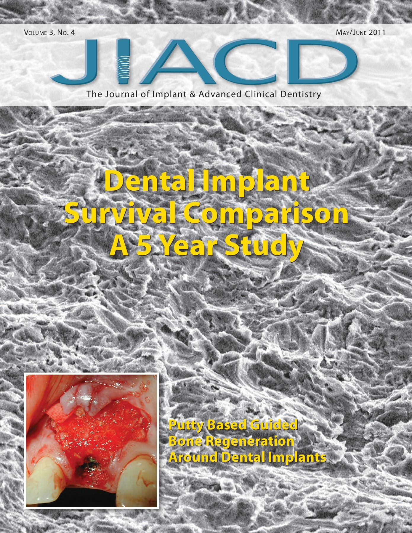 Journal of Implant and Advanced Clinical Dentistry June 2011 - JIACD ...