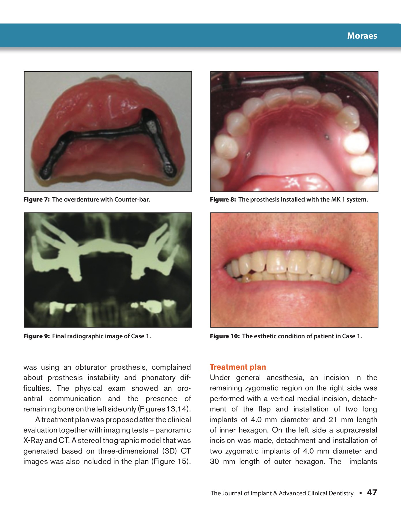 Integrating Implant Function and Esthetics - JIACD - Page 47 | Flip PDF ...