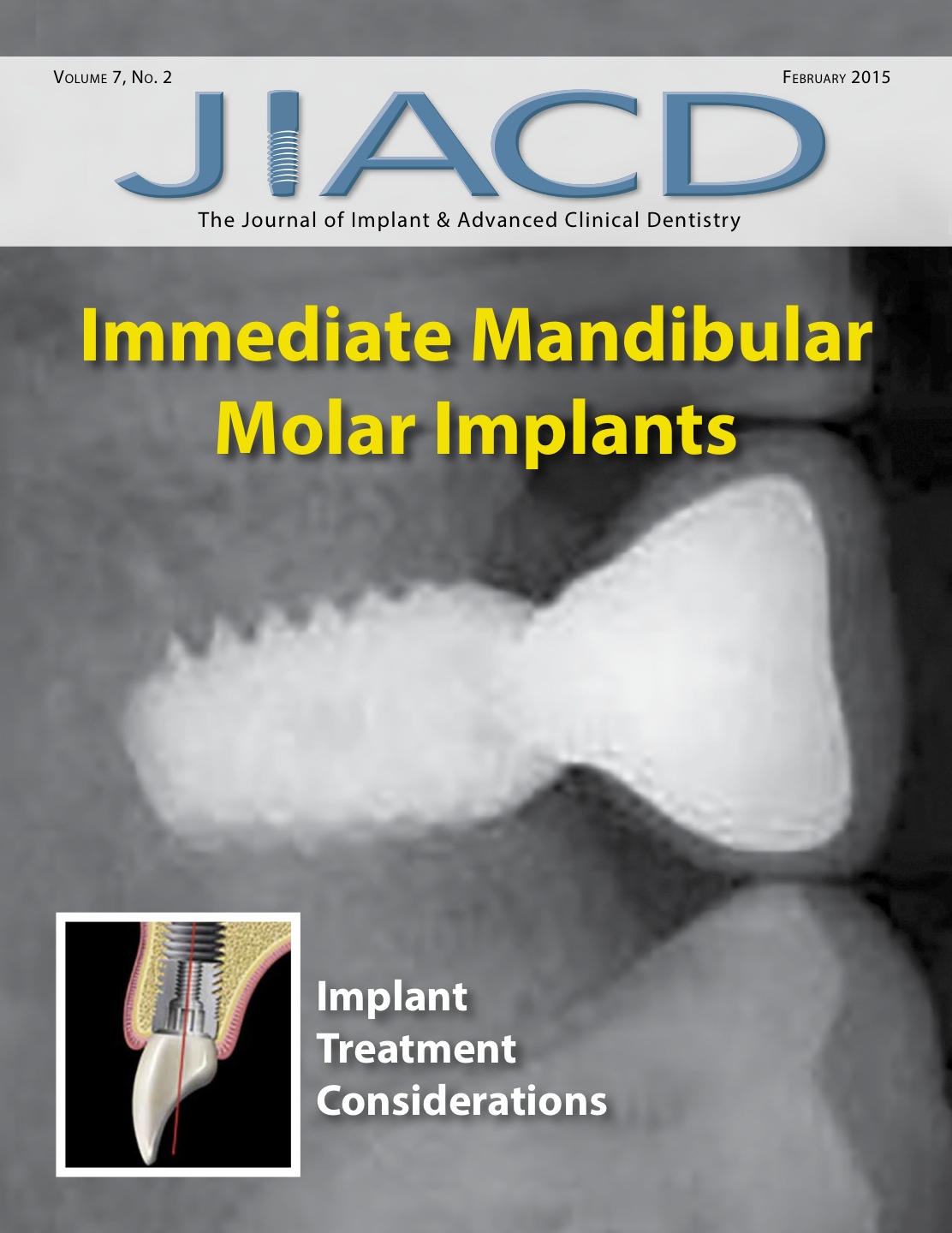 Journal of Implant and Advanced Clinical Dentistry February 2015 ...